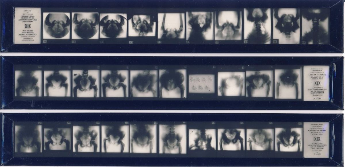 set cu 30 de imagini. radiologice - INP, Bunuri culturale mobile ...